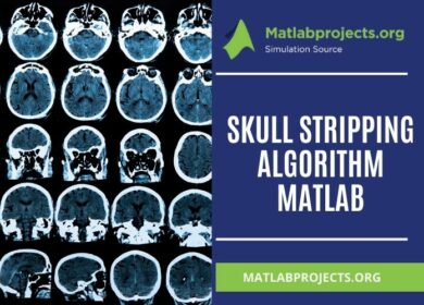 Performance Evaluation of Skull Stripping Algorithm Matlab Programming